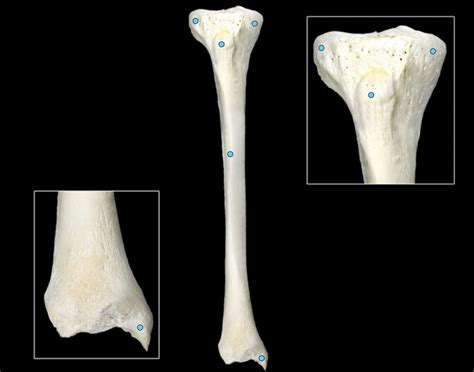 Tibia Anterior View Diagram Quizlet Tibia Anterior View Diagram Quizlet