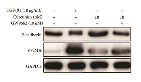 PPARγ antagonist GW9662 reverses TGF β1 induced EMT in IEC 6 cells a