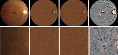 Image Preprocessing Steps A Original Image I B Illumination Download Scientific Diagram