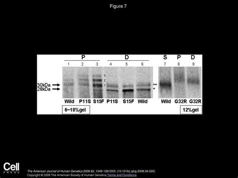 Hyperglycosylation And Reduced Gaba Currents Of Mutated Gabrb3