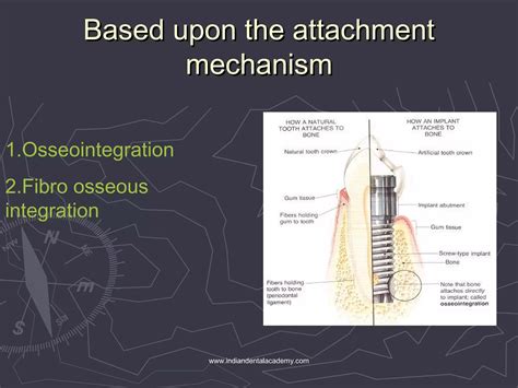 Classification And Impression Techniques Of Implants Dentistry Dental Implants Ppt