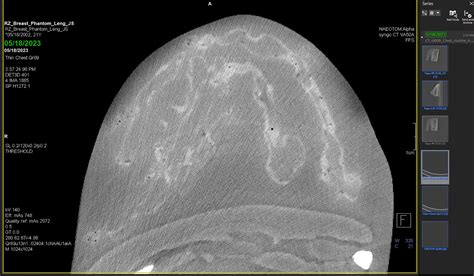 Adult Breast For X Ray Ct Scan And Ultrasound