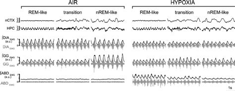 Hypoxic Response Across Brain States EEG NCTX And HPC And EMG DIA Download Scientific
