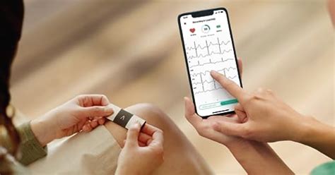 Sotalol For Afib Pros Cons And Side Effects Explained