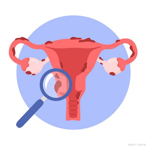 遇到位很勇的姐妹：“谁痛谁知道，我就是要切子宫！”