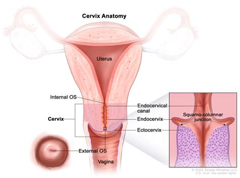 Figure Anatomy Of The Cervix The Pdq Cancer Information