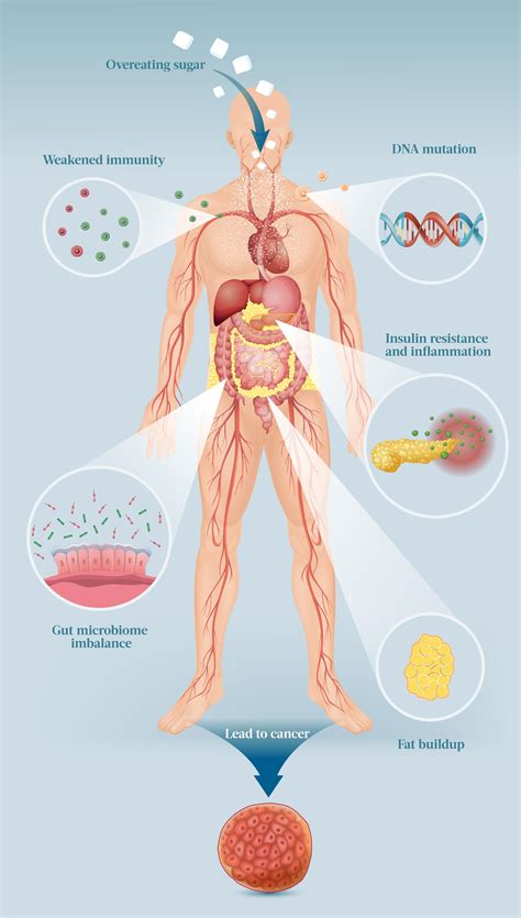 How Sugar Fuels Cancer In The Body Dr Farrah Md