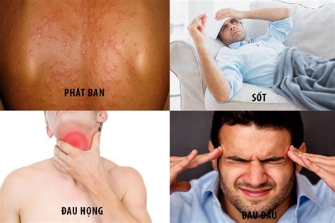 4 dấu hiệu nhận biết bệnh HIV ở nam giới sớm nhất