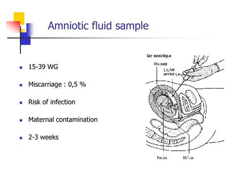 Ppt Dr Cédric Le Caignec Service De Génétique Médicale Powerpoint