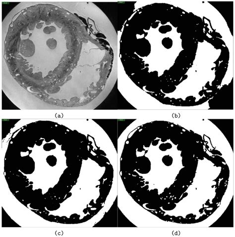 Automated Segmentation Results A Transversal Slice Through The Download Scientific Diagram