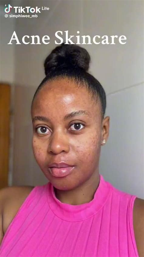 Acne Skincare Routine Skin Care Acne Dark Skin Makeup Face Skin Care