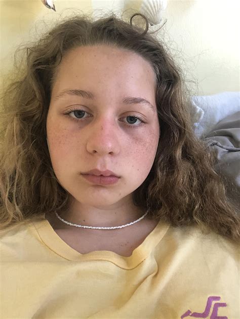 Super Puffy From Some Crying Lol But Had Some Nice Freckles After A