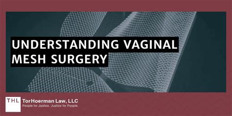 Vaginal Mesh Surgery Options For Vaginal Mesh Complications