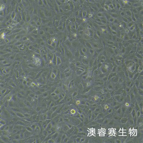 Huv Ec C Huvec （人脐静脉血管内皮细胞）报价价格性能参数图 澳睿赛生物生物器材网