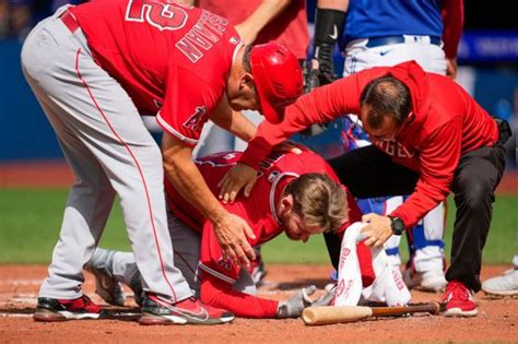 【mlb】顔面骨折のエ軍ウォード、今季絶望も 60日間の負傷者リスト入り球団発表 ライブドアニュース