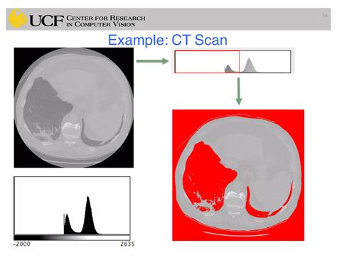 Lec7 Medical Image Segmentation I Radiology Applications Of Segmentation And Thresholding