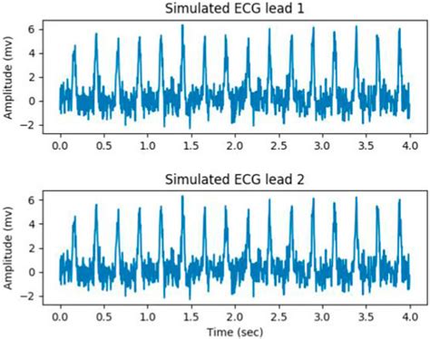 Frontiers A Simple And Effective Deep Neural Network Based Qrs Complex Detection Method On Ecg