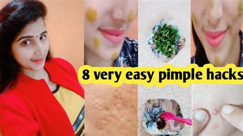पपलस क ठक करन क आसन तरक pimple remove tips how to remove pimple in days