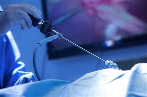 Inguinal Hernia Surgery Scottish Hernia Centre