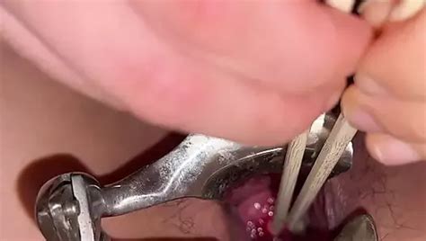 Uterine Mouth Suction Xhamster