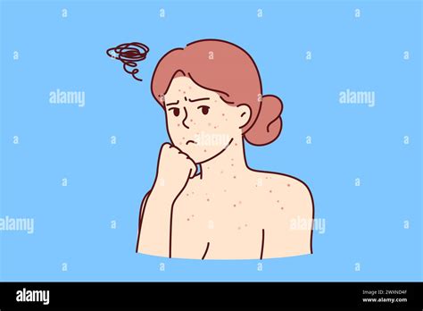 Woman With Allergic Rash On Face And Body Looks Sadly At Screen