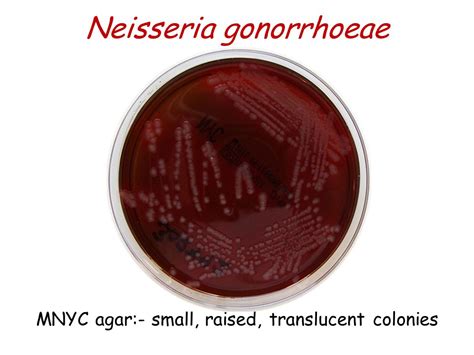 Neisseria Gonorrhoeae Resistance To Antibiotics