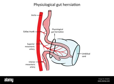 Single Umbilical Anatomy Of Umbilical Cord With One 48 Off