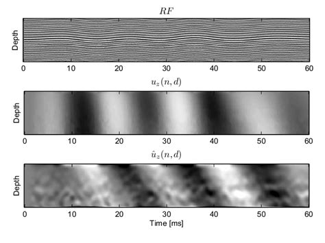 Experimental Setup Used For Quantitative Validation The Actuator Was