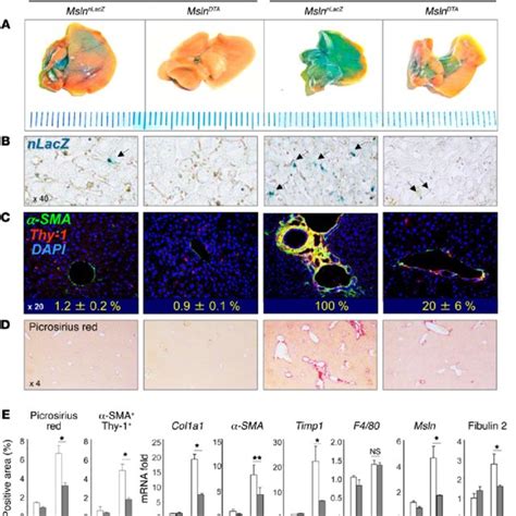 Msln Muc16 Signaling Regulates Activation Of Apfs Myofibroblasts In