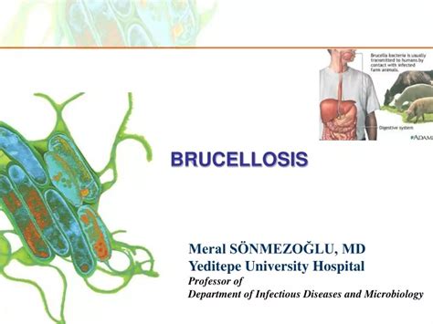Ppt Brucellosis Powerpoint Presentation Free Download Id9438717