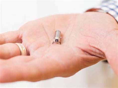 Patient Is First In Tennessee To Get Pill Sized Pacemaker