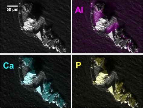 Sem Image Of A Highly Fragmented Calcification Note The Shadowing Of Download Scientific
