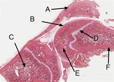 Diagram Of Bone And Cartilage Quizlet