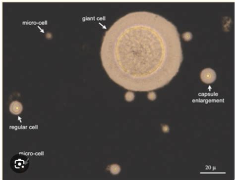 Day 12 Systemic Mycoses Infectious Cycles Flashcards Quizlet