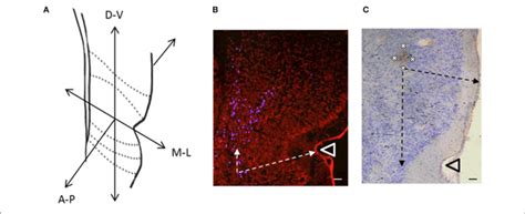 A Coronal Cross Section Of Temporal Cortex At 3 3 Mm Posterior To Download Scientific