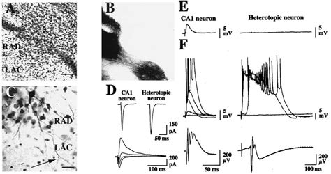 Neocortical Heterotopias Receive Hippocampal Inputs A Download