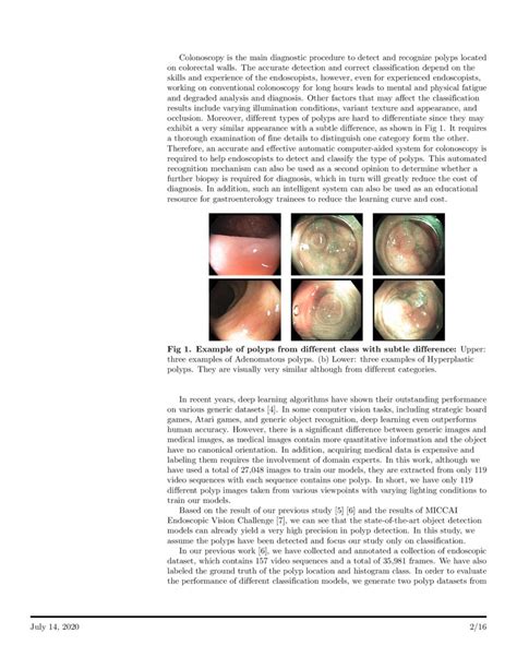 A Comparative Study On Polyp Classification Using Convolutional Neural