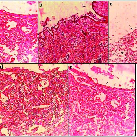 Histological Micrographs Of Sprague Dawley Rat Vaginal Epithelium