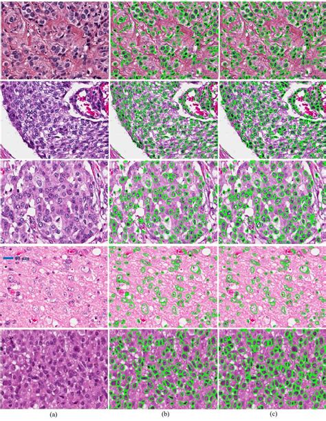 Qualitative Performance Of Nuclear Segmentation Is Shown For Five Download Scientific Diagram