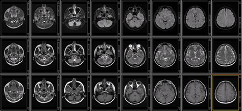 건강한 남성의 뇌 Mri 스캔 고해상도 Spect 스캐너에 대한 스톡 사진 및 기타 이미지 Spect 스캐너 Cat 스캔