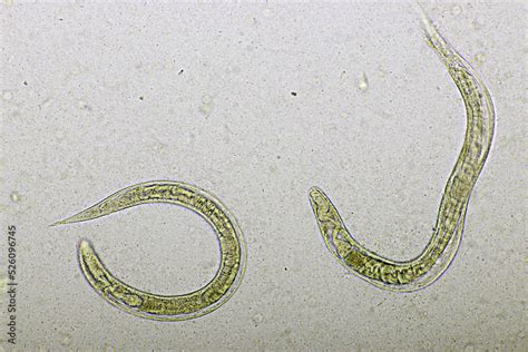 Strongyloides Stercoralis Or Threadworm In Human Stool Analyze By