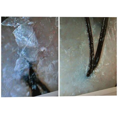 How Top Open Up Clogged Scalp Pores With Herbs Southern Babes Designs