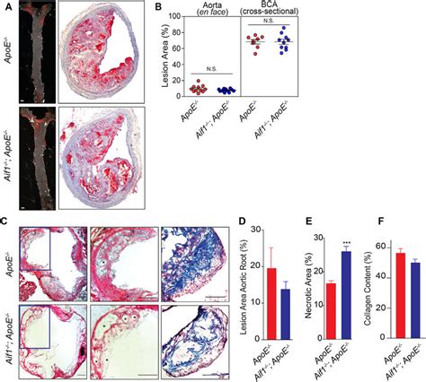 Aif1 Limits Necrotic Core Expansion Without Affecting Atherosclerotic Download Scientific