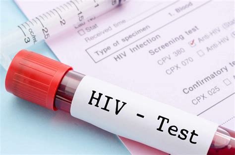 CTA de Picos já registrou quatro casos de HIV em 2020 Noticiei