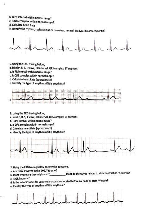 Solved Question 1 Determine The Qrs Axis For This Ecg A