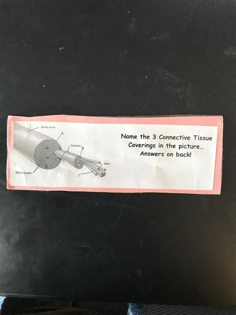 Connective Tissue Diagram Quizlet