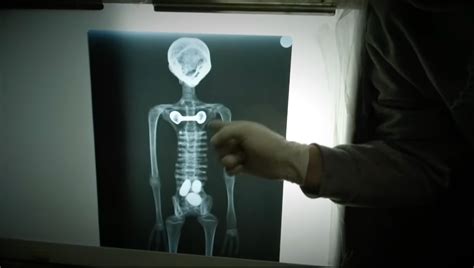 New Twist In Discovery Of 1000 Year Old Alien Bodies As Autopsies