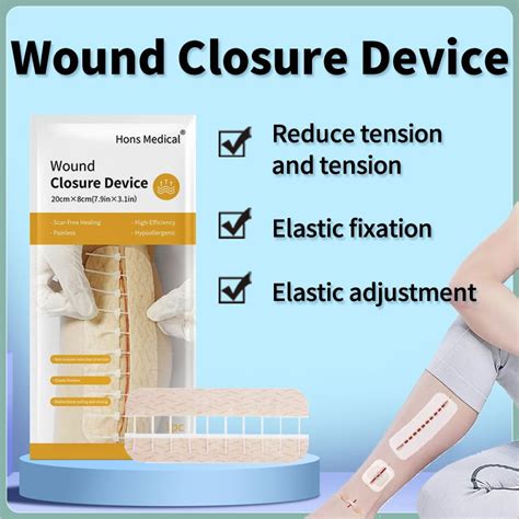 Hons Medical Needle Free Wound Closure Device Easy To Use Honsmedical