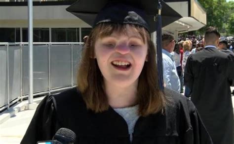 Girl Born Without Eyes Nose Graduates College