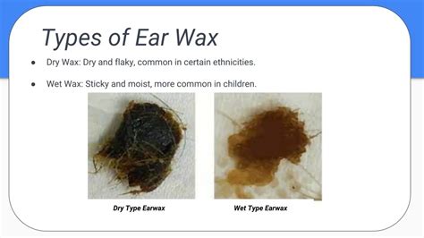 Ppt 2ear Wax Powerpoint Presentation Free Download Id12170557